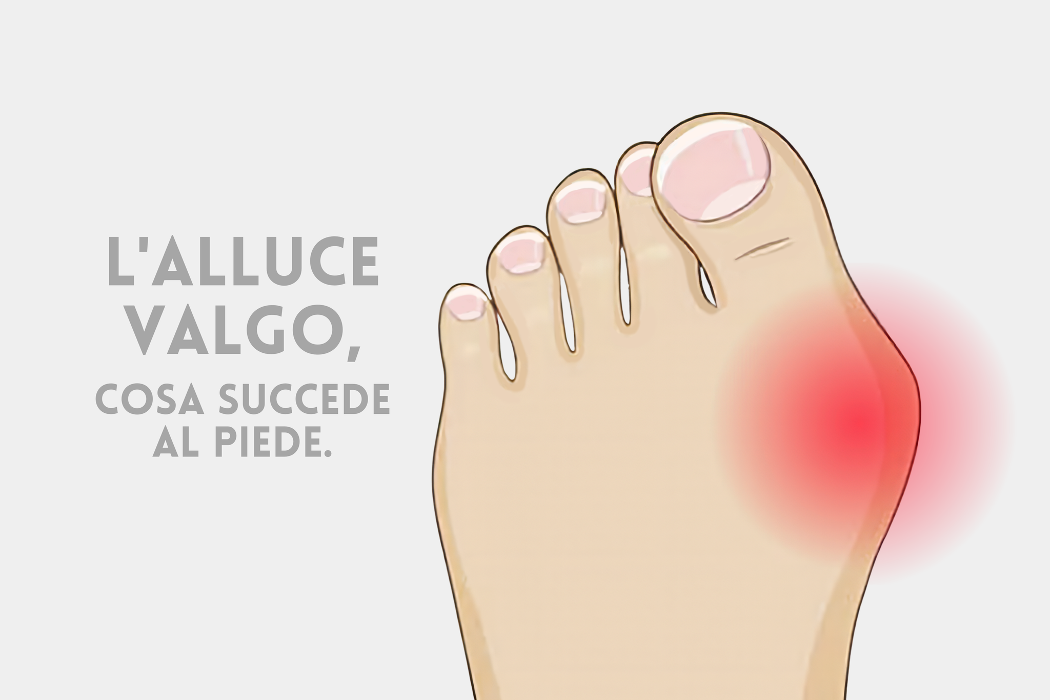 Schuhe für Hallux valgus | YDA Ratgeber zur Auswahl